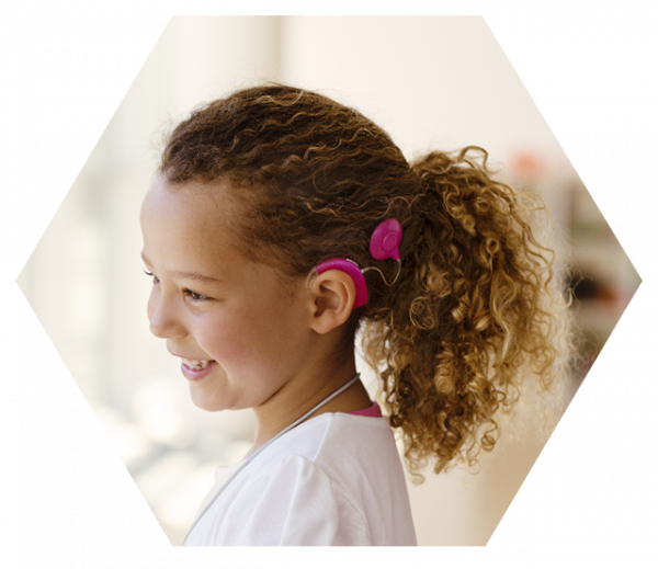 Cochlear Implant 101 - because sound matters